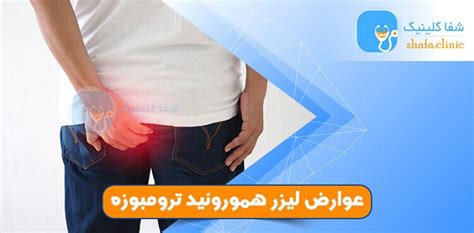 جراحی لیزر هموروئید ترومبوزه گوشت اضافه مقعدی شفا کلینیک