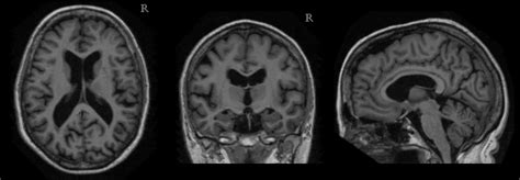 10 Best Free Healthcare Datasets For Machine Learning