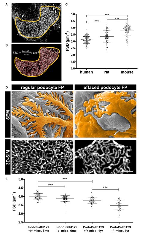 Figure 2 From Comparative Analysis Of Podocyte Foot Process Morphology