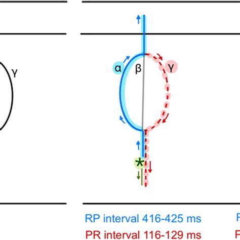 Hypothetical Model Of Triple Av Nodal Pathways Three Pathways Of Download Scientific Diagram