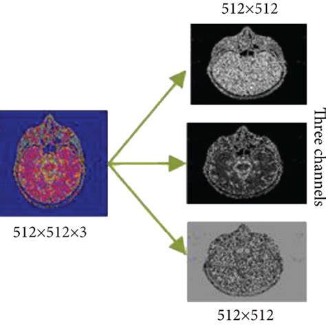 Pdf An Improved Brain Mri Classification Methodology Based On