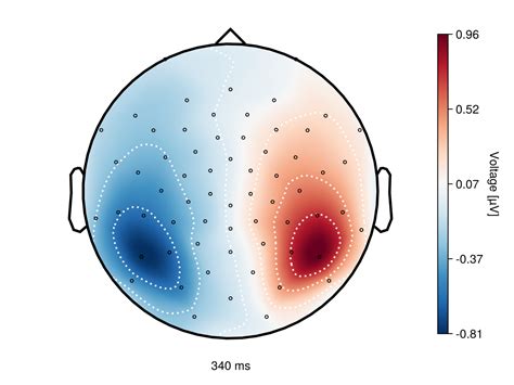 Topoplot · Unfoldmakie Jl