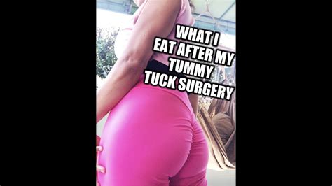 Full Day Of Eating After My Tummy Tuck Youtube