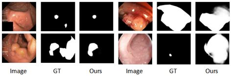 bmfa net boundary constraint multi level feature aggregation framework