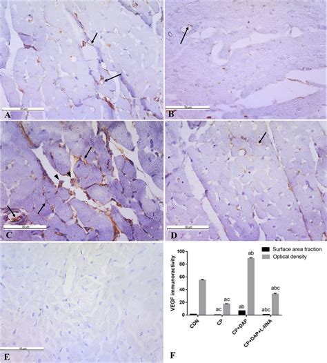 Effect Of Dap On Vegf Immunoexpression Representative Photomicrographs