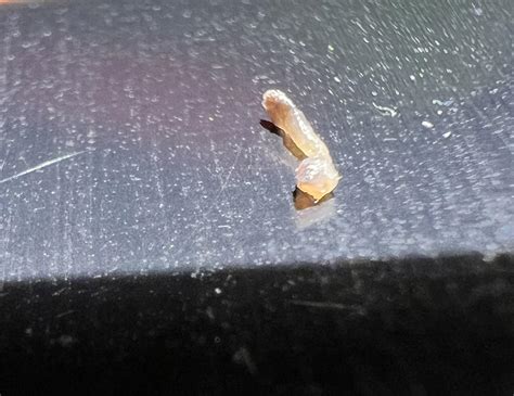 Is This A Bug 25mm Pulled Out Of The Side Of Someones Penis Looked