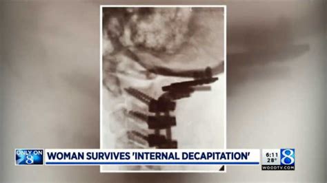 Til You Can Have An Internal Decapitation