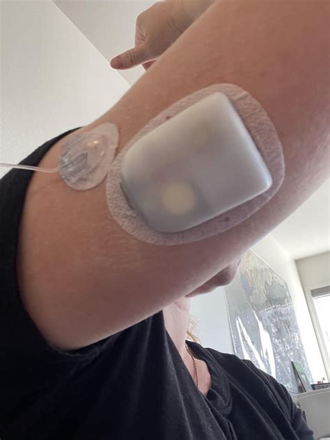 Omnipod The Discreet Insulin Pump 🙄 Rdiabetes