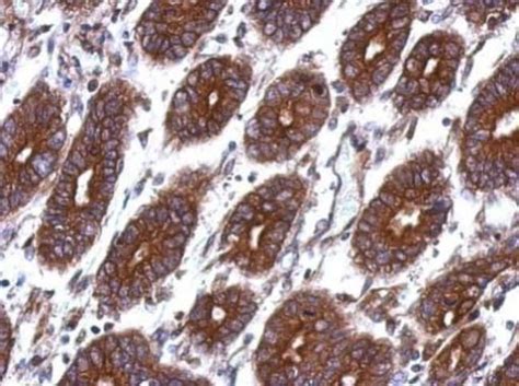 Tk1 Rabbit Anti Human Mouse Polyclonal Invitrogen 100 µl