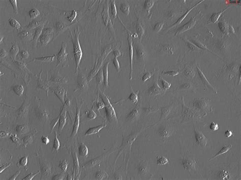mouse hepatic mesothelial cells mhmec