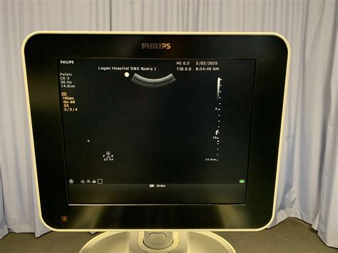 Philips C6 2 Broadband Curved Array Probe Ultrasound Transducer For