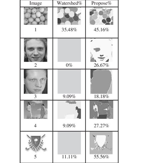 Segmentation Results On Set1 Download Scientific Diagram