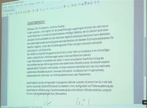 Chrupalla äußert Sich Erstmals Selbst Zu Dem Nadelstich Vorfall
