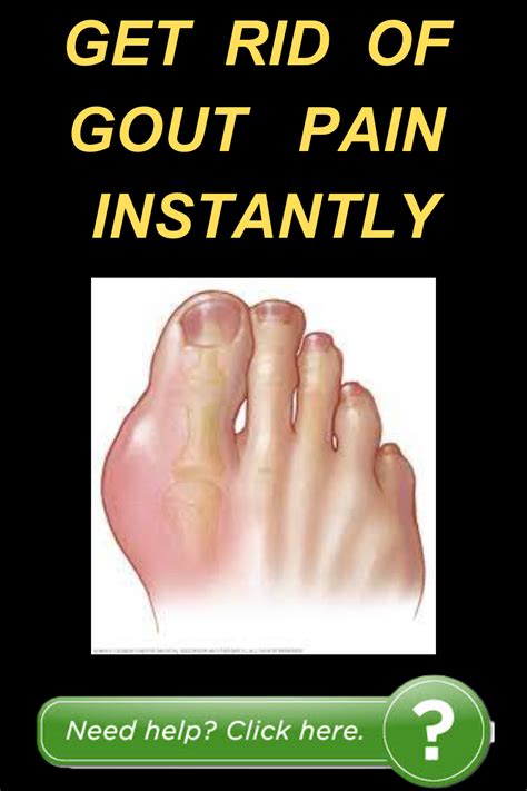 Baking Soda For Gout Does It Work Artofit