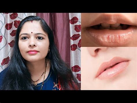 How to make lips soft and pink naturally घरल नसख YouTube