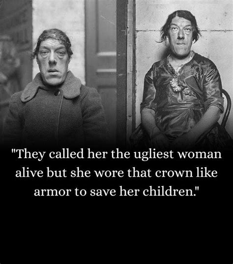 The Curiosity They Called Her The Ugliest Woman Alive—but She Wore