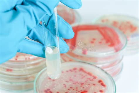 Microbiology Laboratory Test Stock Image Image Of Chemical Microorganisms 92276049