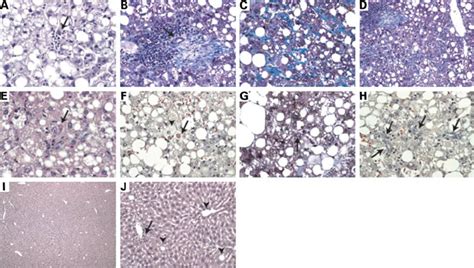 Development Of Nash A H Histopathological Features Of Nash In