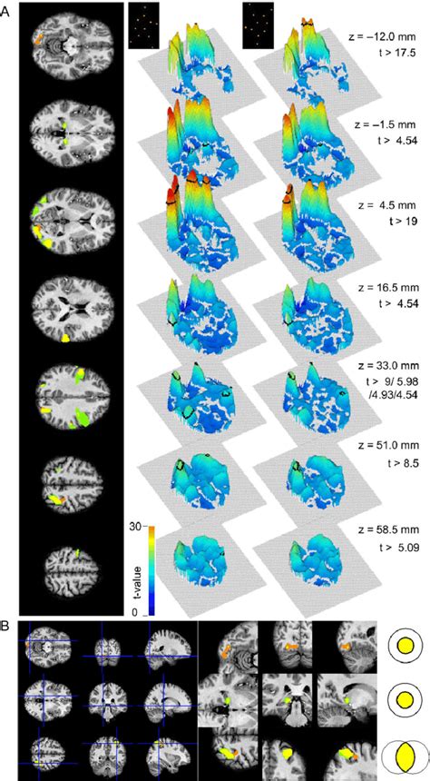 Functional Mri Activation To Biological Motion Presented Upright And