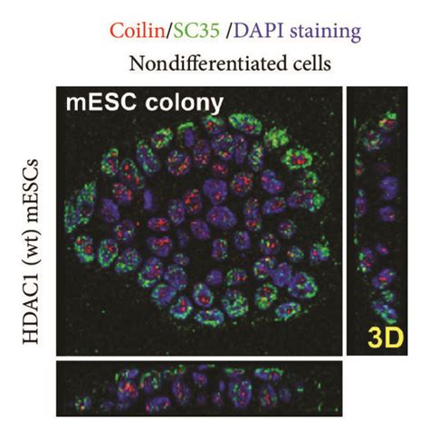 Spatial Interactions Between Coilin And Sc35 Positive Splicing