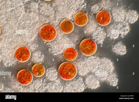 Haematococcus Sp Algae Light Micrograph Stock Photo Alamy
