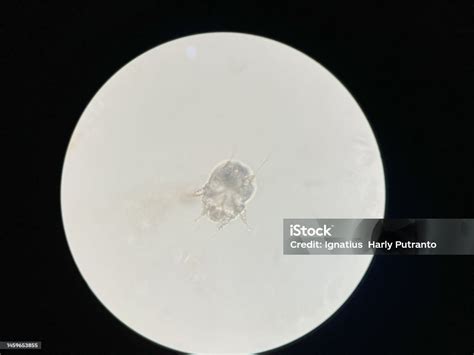 Notoedres Cati Under The Microscope Notoedric Mange Also Referred To As
