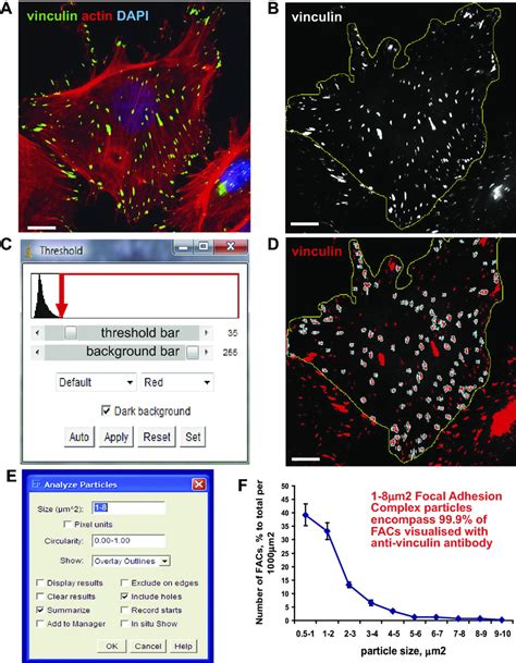 Quantification Of Focal Adhesion Complexes In Podocytes A An Image Of