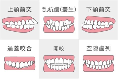 矯正歯科｜しばやま歯科診療所