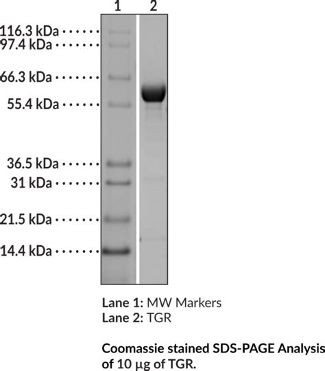 Thioredoxin Glutathione Reductase Schistosoma Mansoni Recombinant