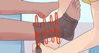 How To Wrap A Sprained Thumb Easy Step By Step Guide
