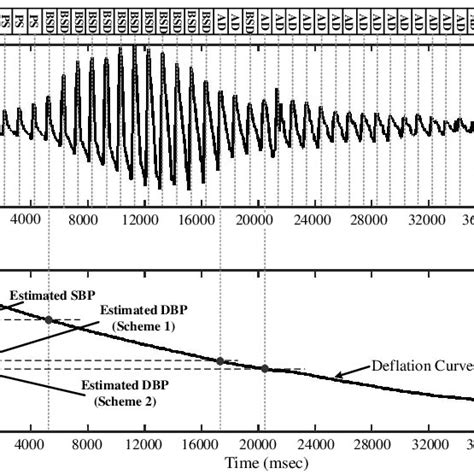 illustration of estimation of sbp and dbp based on detected class