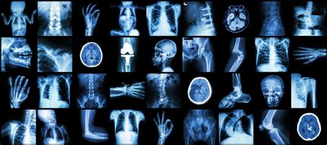 How To Convert Grayscale Dicom File To Rgb Dicom File With Python By Jae Won Choi Md