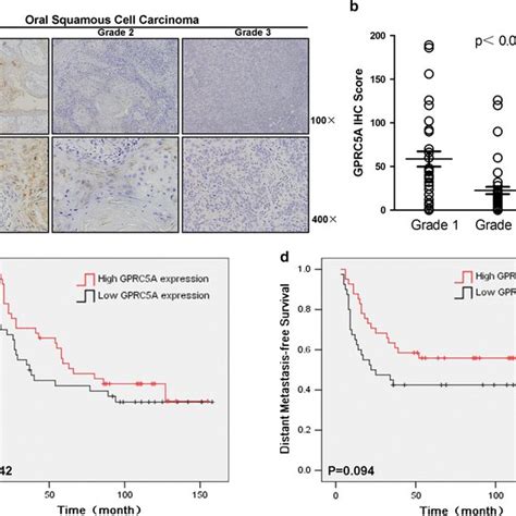 Expression Pattern Of Gprc5a In Human Normal Tissues And Head And Neck