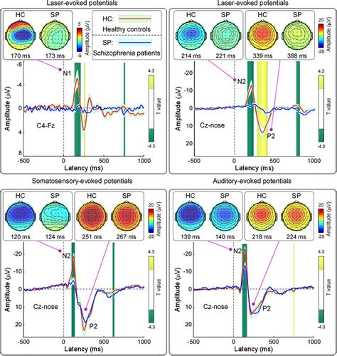 Group‐level Event‐related Eeg Responses To Sensory Stimuli In The Time