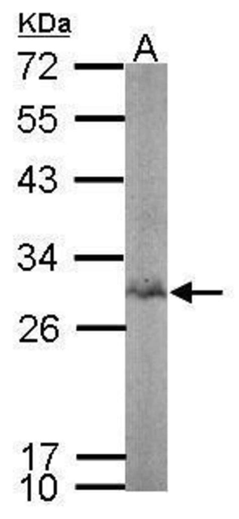Bisphosphoglycerate Mutase Polyclonal Antibody Invitrogen 100 μl