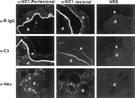 Figure 4 From Evidence That Anti Type Vii Collagen Antibodies Are