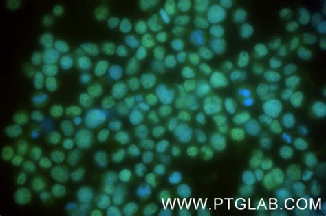 Brd2 Antibody 85990 2 Rr Proteintech