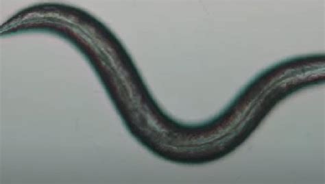 Pancreatic Cancer Kaya Raw Ma Detect Ng Maliliit Na Bulate Na Malakas