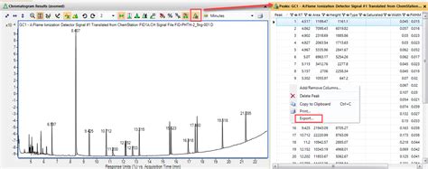 Urgent Masshunter Qualitative Analysis Qual — Export Gctcd