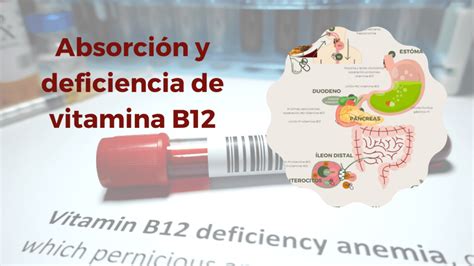 AbsorciÓn Y Deficiencia De La Vitamina B12