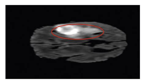 Confidence Region Contour Detection A T1 Sequence Original Image
