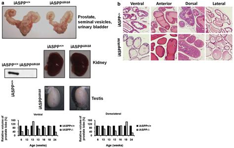 Phenotypic Analysis Of IasppΔ8Δ8 Mouse Prostates A The Prostate