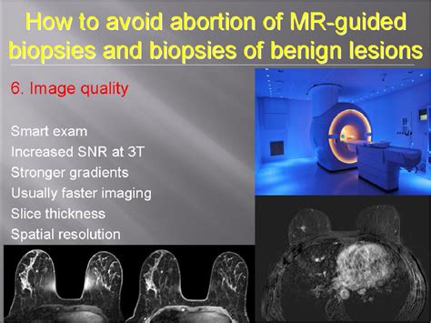 Figure 2 From Dynamic Features Of Mr Guided Histologically Proven