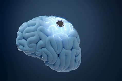 Elon Musks Neuralink Wants To Implant Chip In Second Human Patients