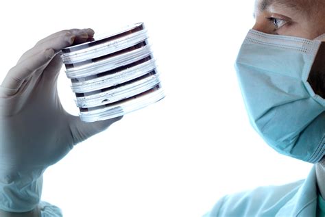 Bd™ Bruker Maldi Biotyper® Ca System Bd