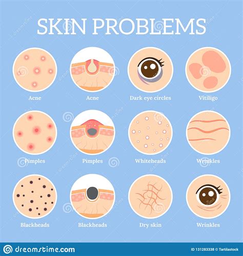 Skin Problems Ages Wrinkles Problem Face Skin Infection Treatment Dark