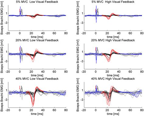 Sample Meps From A Single Participant Single And Paired Pulse