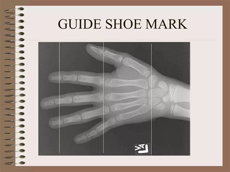 Radiographic Artifacts Ppt Science