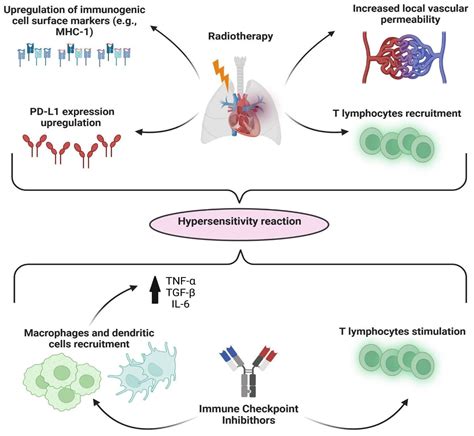 Radiation Recall Pneumonitis Anticipates Bilateral Immune Induced Pneumonitis In Non Small Cell