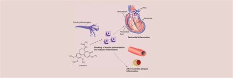 In Focus Colchicine Exsyn